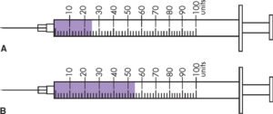 Insulin Syringe Units Explained: U-100, U-40, U-50